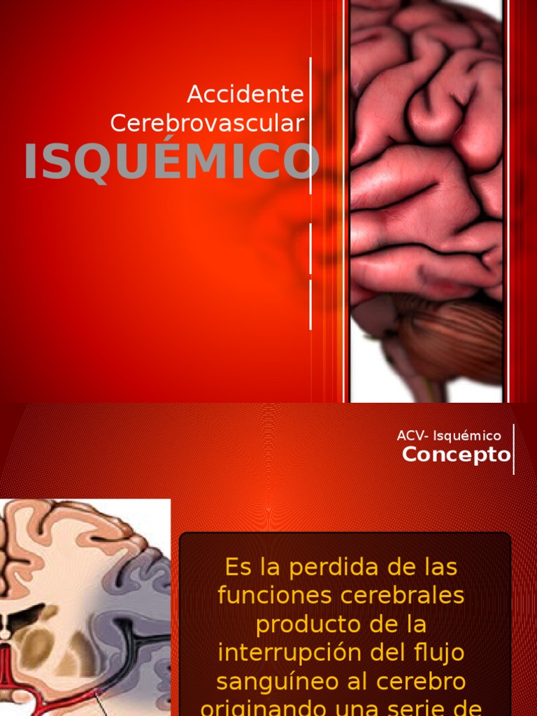 Accidente Cerebrovascular Isquémico | PDF | Carrera | Isquemia