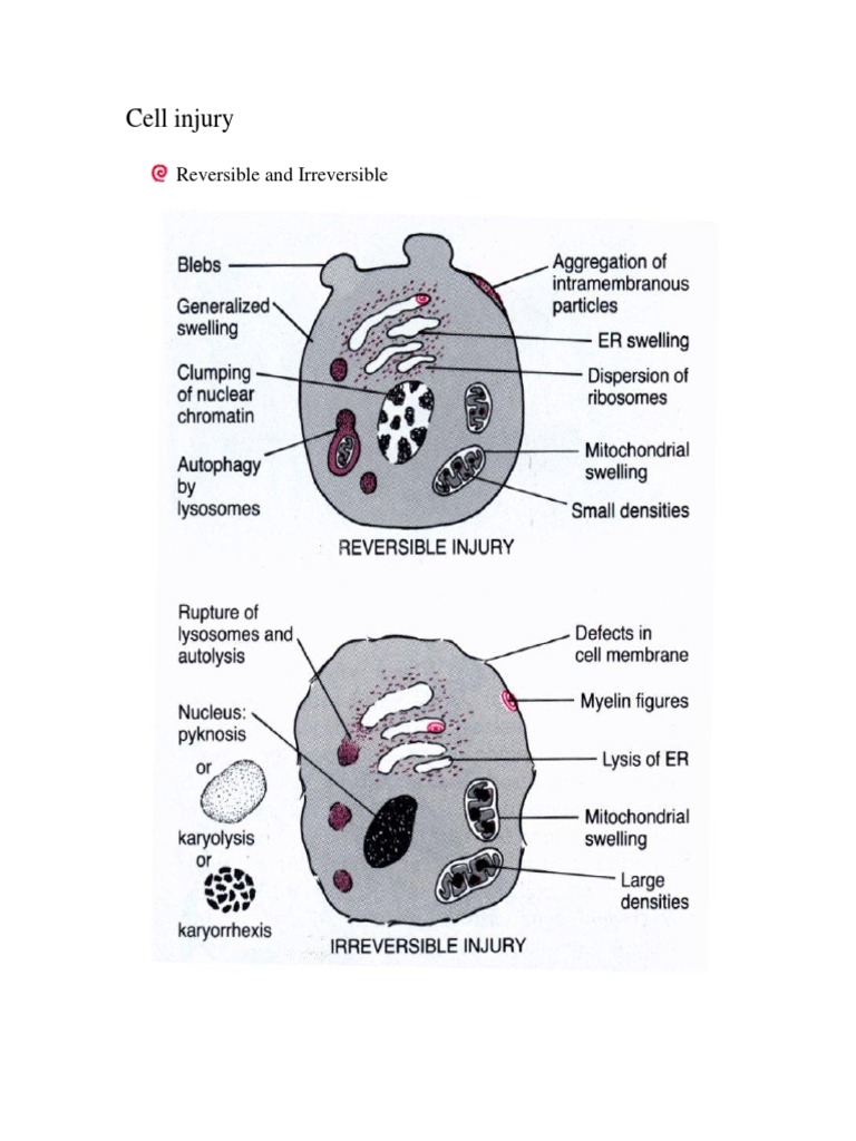 Cell Injury: Reversible and Irreversible | PDF