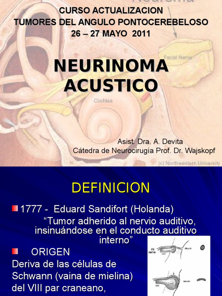 Neurinoma xwx | Neurología | Sistema nervioso