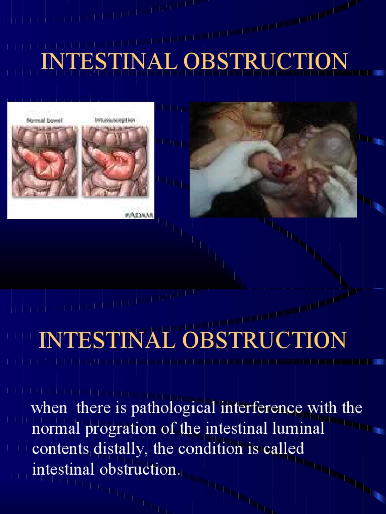 Nonmechanical Intestinal Obstruction Overview | PDF | Digestive System ...