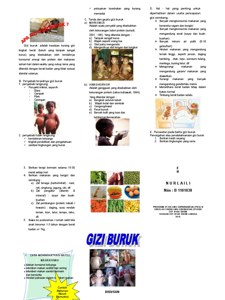 Leaflet Gizi Buruk | PDF