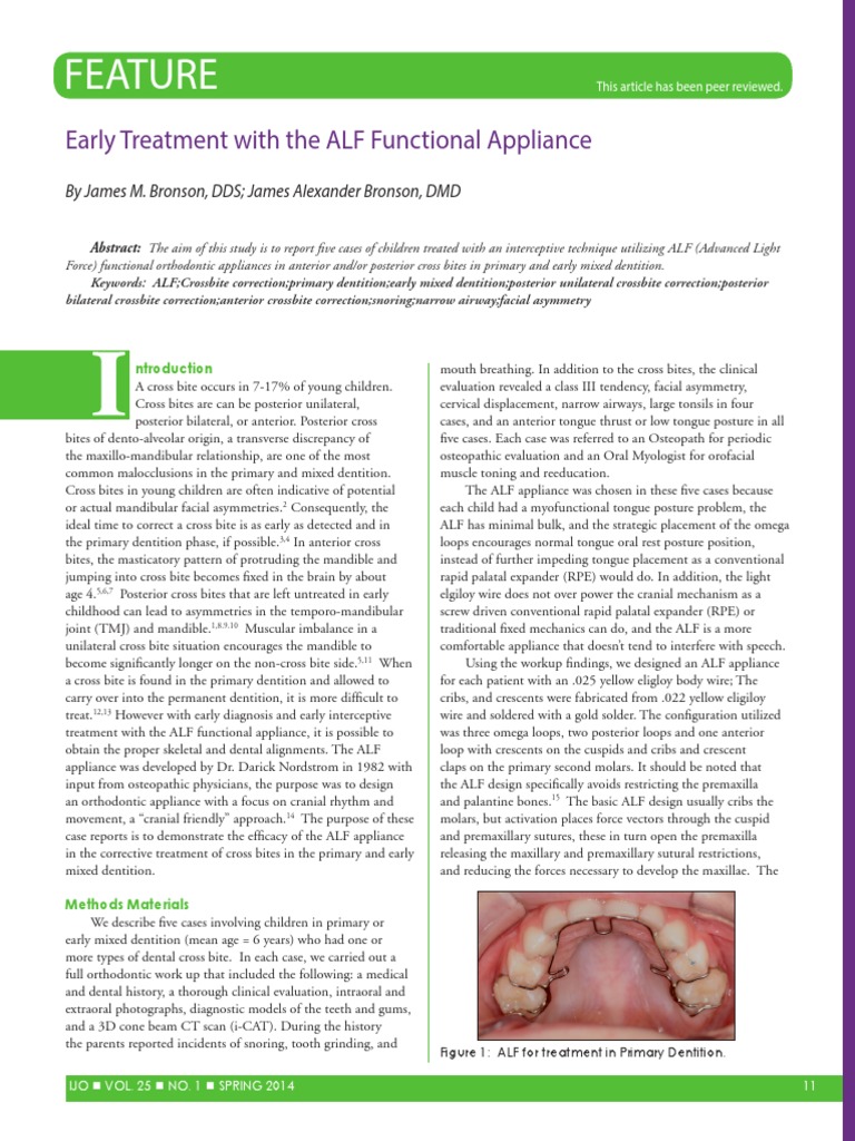 ALF Functional Appliance | PDF | Orthodontics | Dentistry