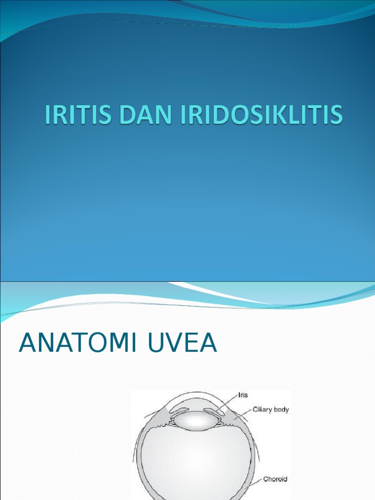 Iritis Dan Iridosiklitis | PDF