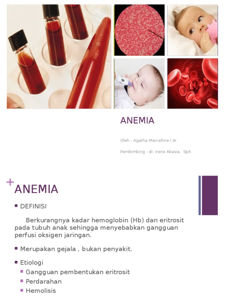 Panduan Lengkap Anemia pada Anak | PDF | Pengembangan Diri | Kesehatan ...