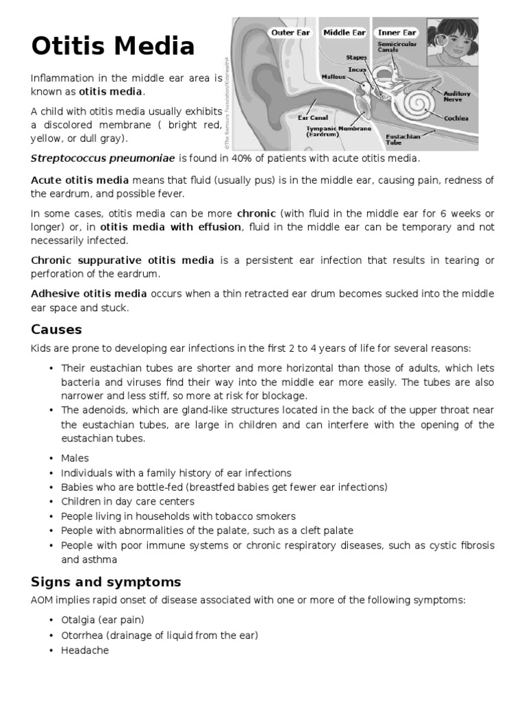 Otitis Media | Auditory System | Immunology