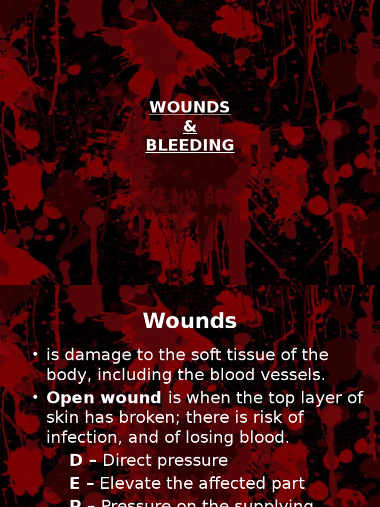 Elementary First Aid - Bleeding | PDF | Wound | Bleeding