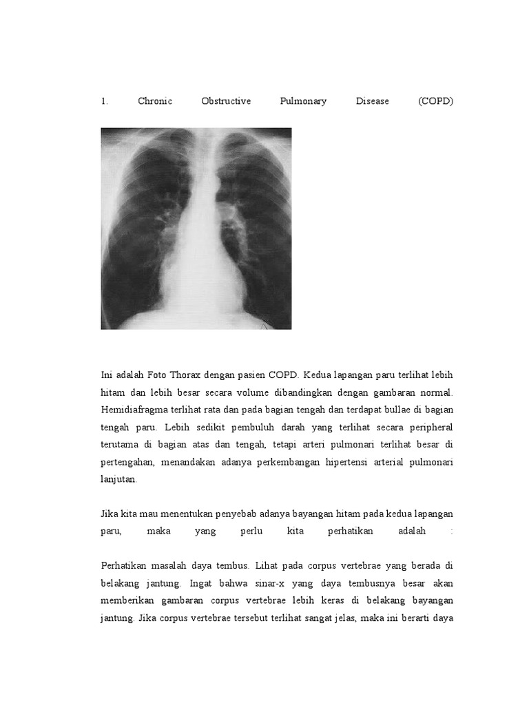 Interpretasi Rontgen Ppok | PDF