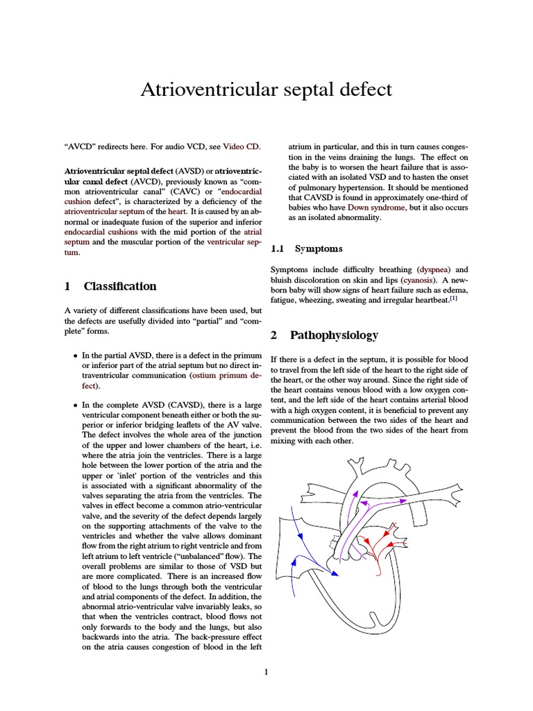 Atrioventricular Septal Defect | PDF | Atrium (Heart) | Congenital ...