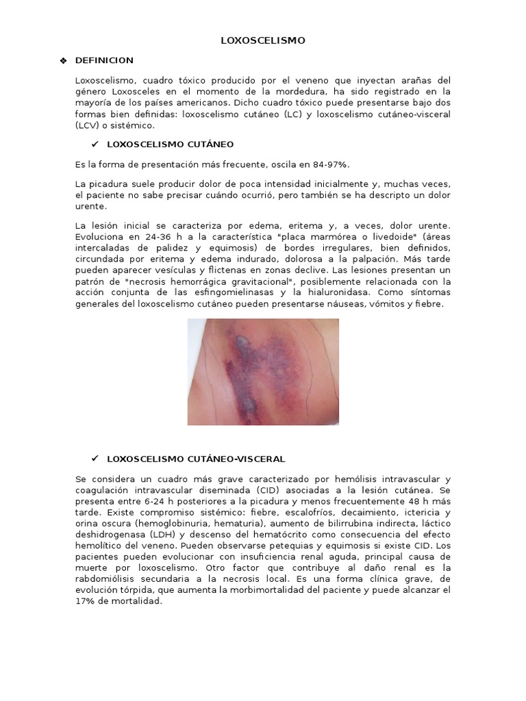 Loxoscelismo | PDF | Medicina CLINICA | Especialidades Medicas