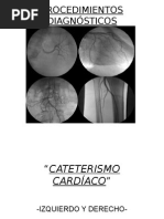 Catéter de Fogarty | PDF | Especialidades Medicas | Medicina CLINICA
