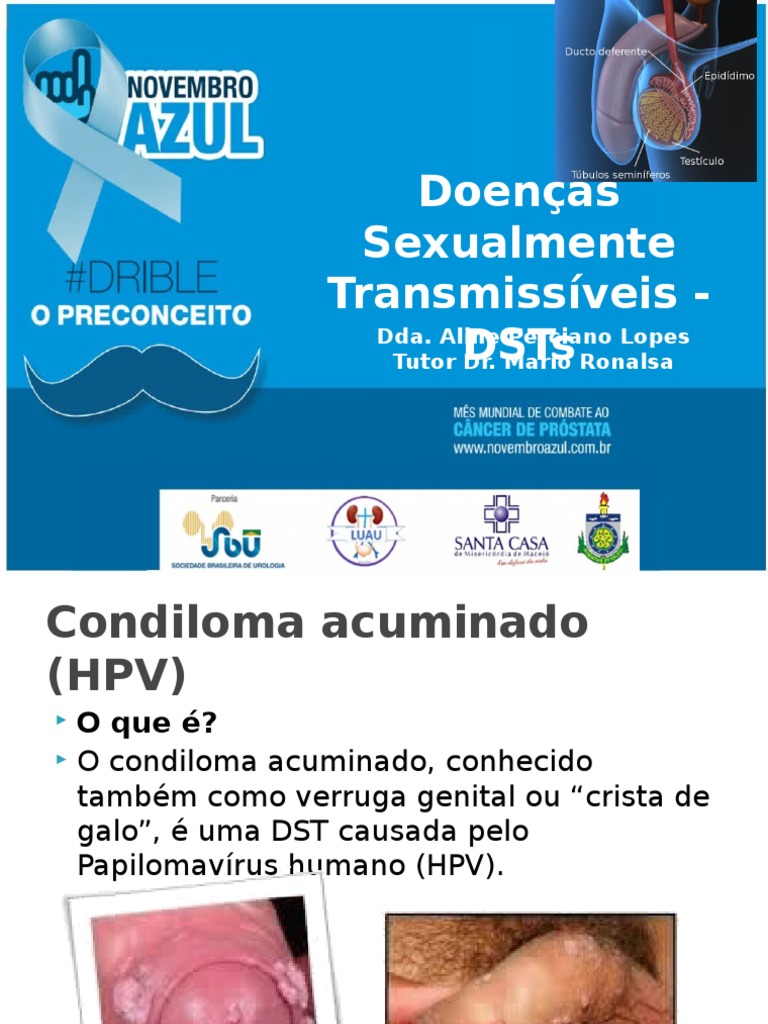 Doenças Sexualmente Transmissíveis: Sinais, Sintomas e Formas de ...