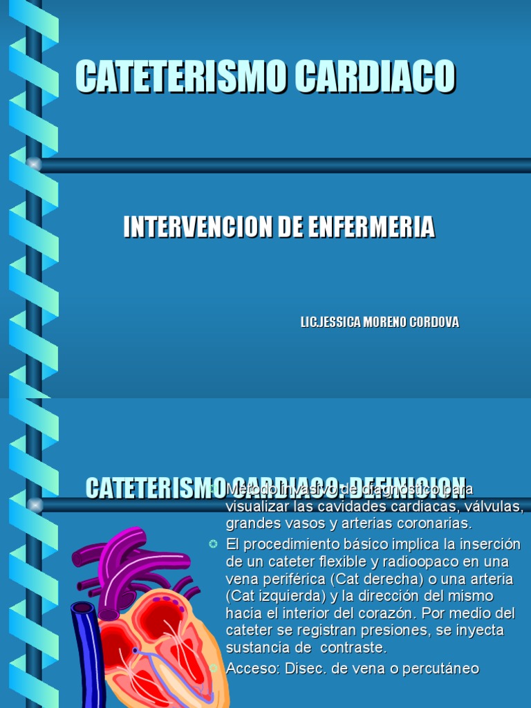 CATETERISMO CARDIACO | Corazón | Arritmia cardiaca