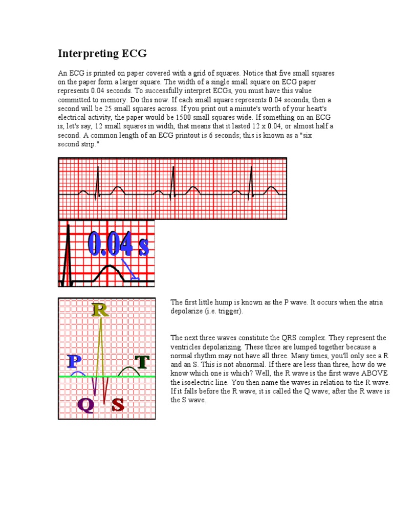 Ecg Interpretation | PDF | Electrocardiography | Cardiovascular System