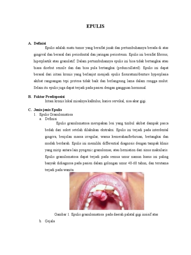 Epulis | PDF