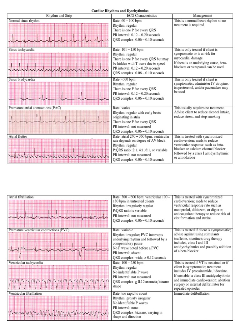 Cardiac Rhythm Cheat Sheet