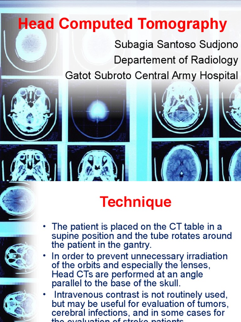 Head Computed Tomography: Subagia Santoso Sudjono Departement of ...