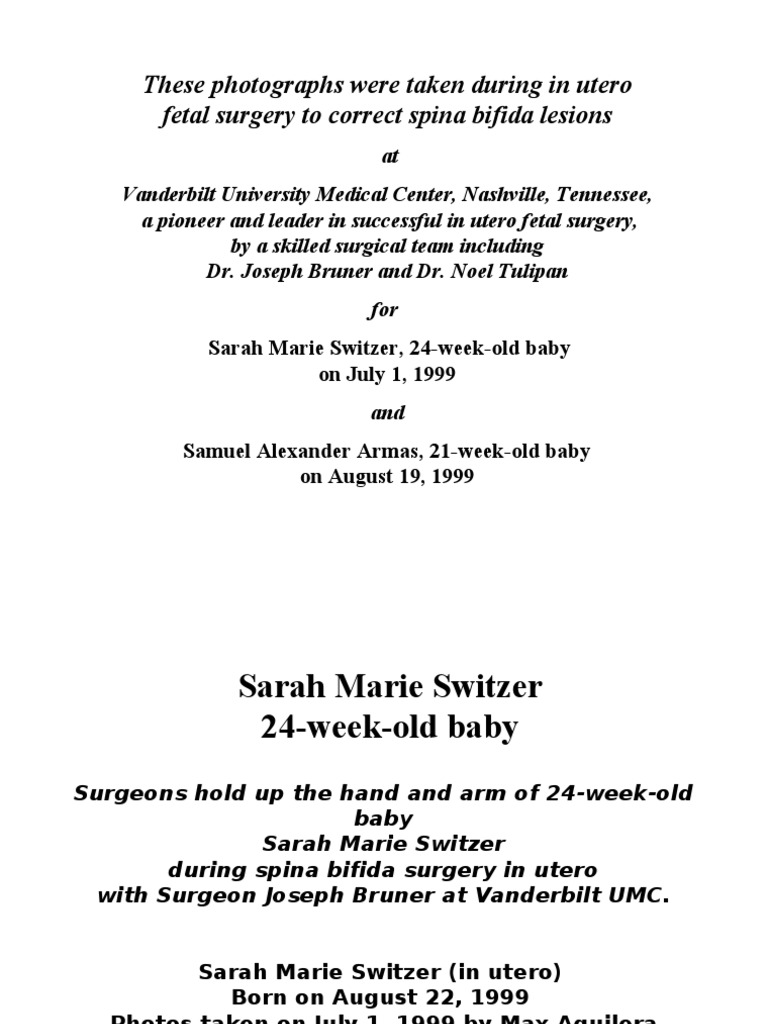 Samuel Armas, Sarah Switzer, in Utero Fetal Surgery For Spina Bifida ...