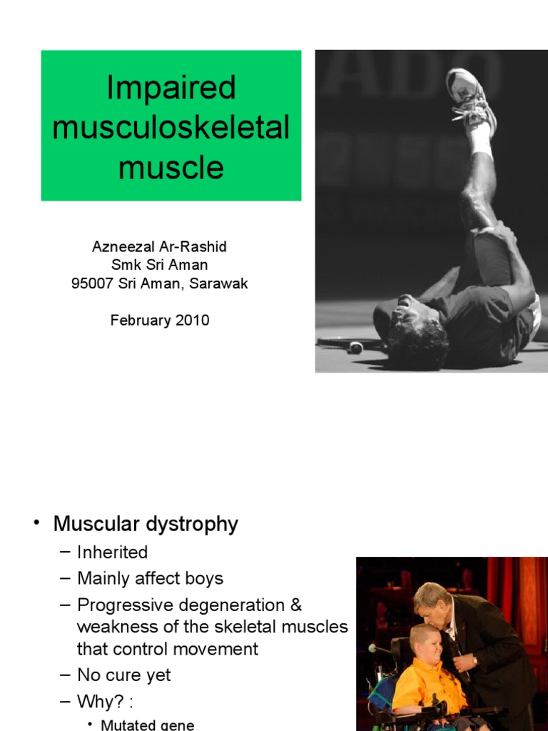 Musculoskeletal Disorders Overview | PDF