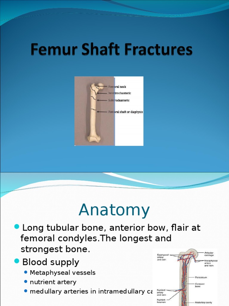 Femur Shaft Fractures | PDF | Knee | Limbs (Anatomy)