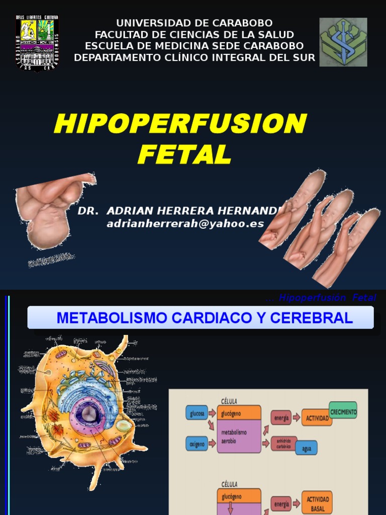 Hipoperfusion Fetal | PDF | Hipoxia (médica) | Feto