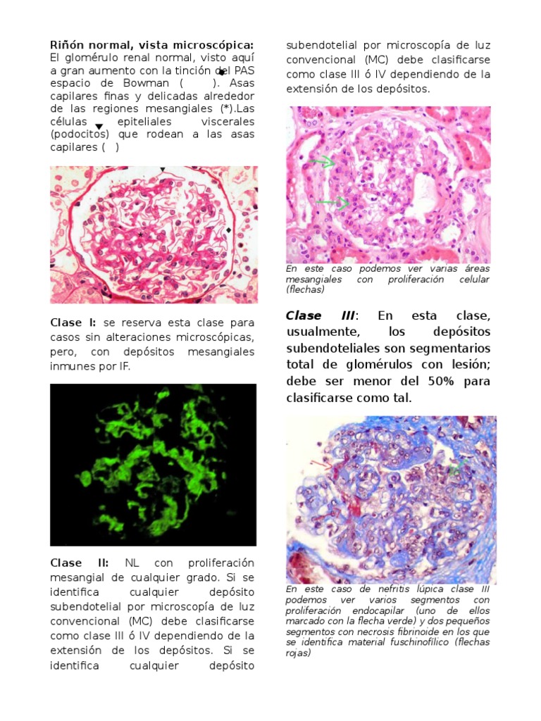 Riñón Normal y NL | PDF | Riñón | Órgano (anatomía)