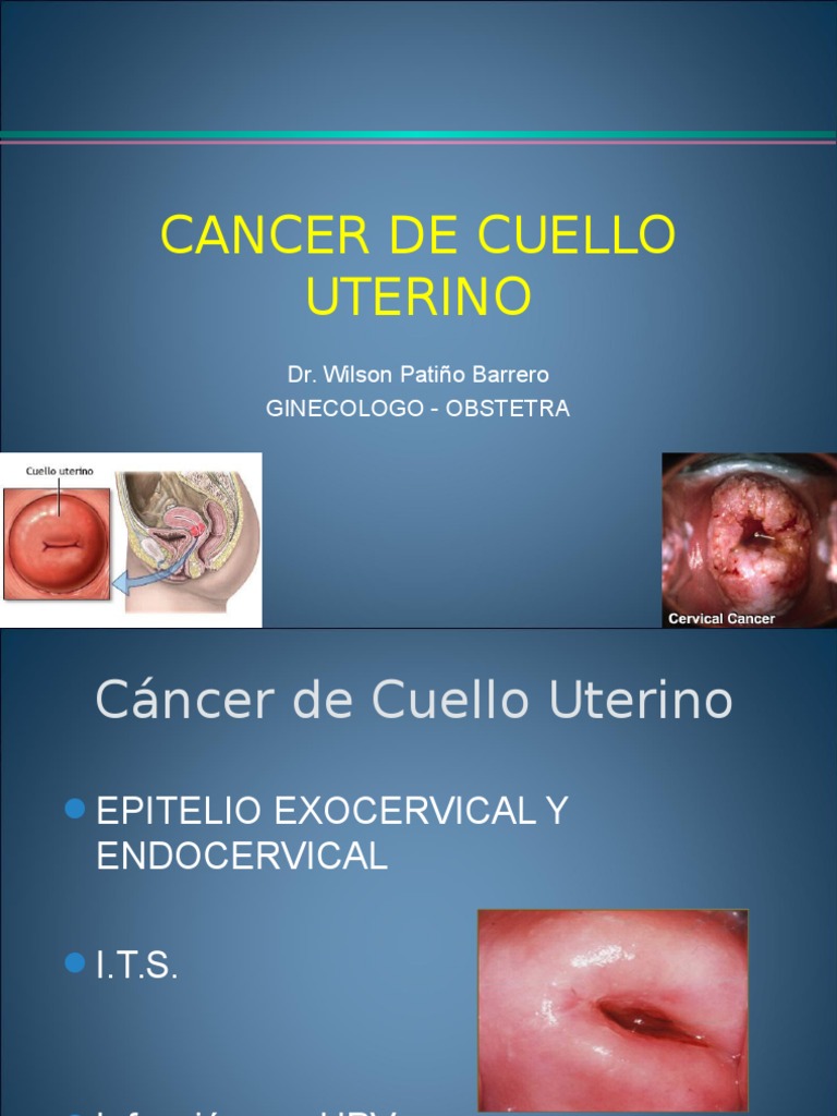 Cancer de Cuello Uterino 2014 | PDF | Cáncer de cuello uterino | Cáncer