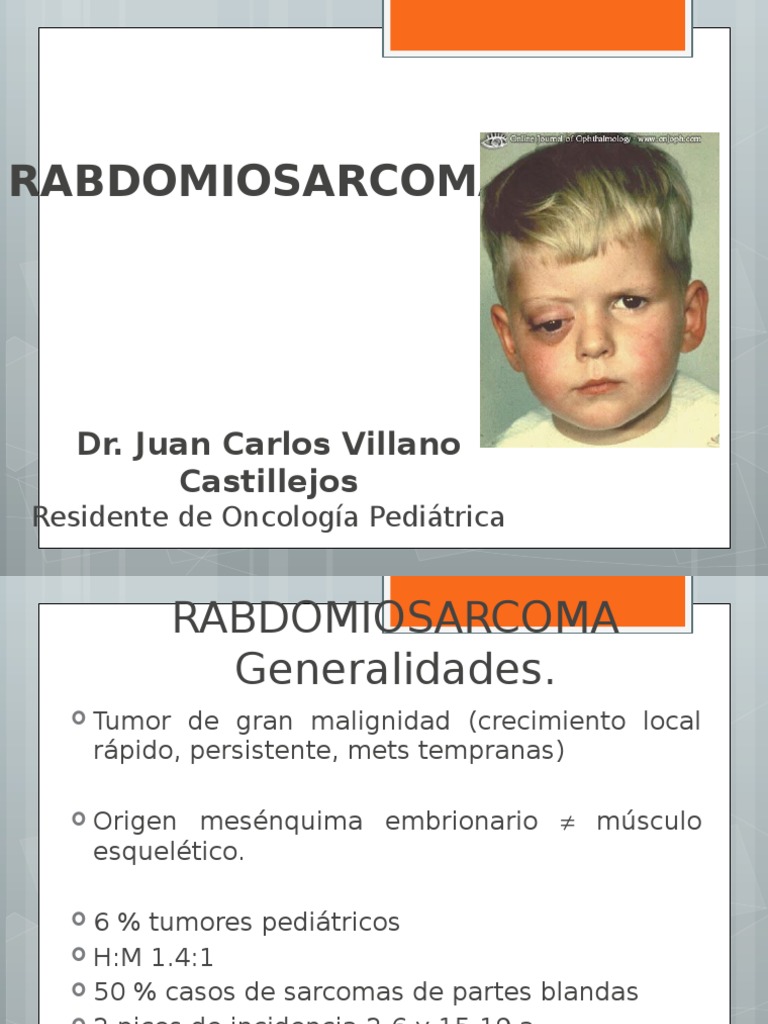 Rabdomiosarcoma Pediátrico Pdf Especialidades Medicas Medicina