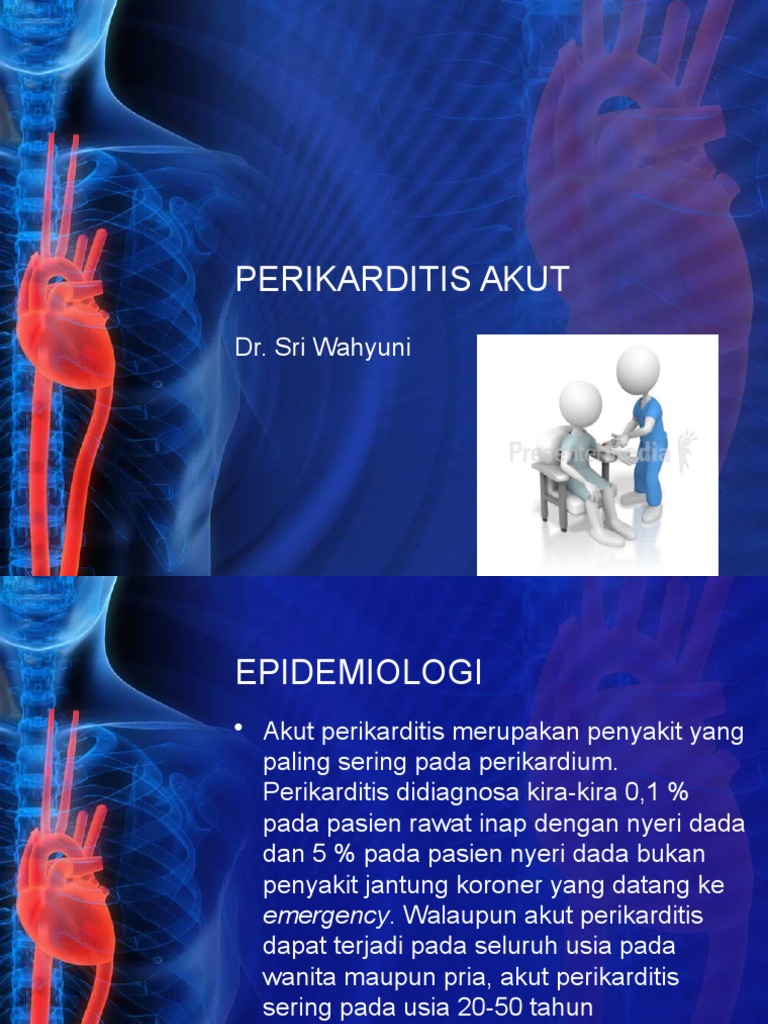 Perikarditis Akut DR Sri | PDF