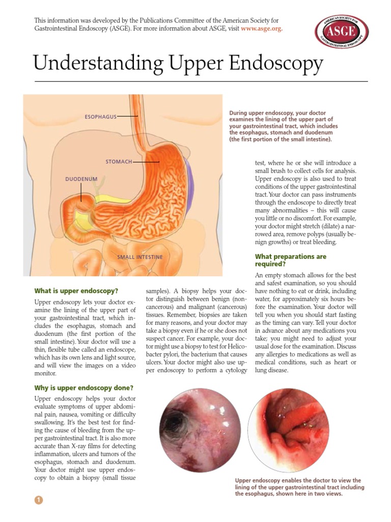 Understanding Ogd | PDF | Endoscopy | Gastrointestinal Tract