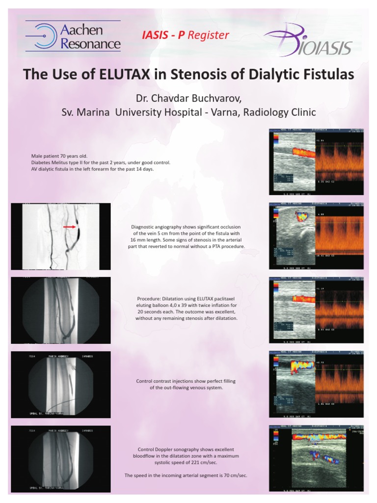 Elutax Poster | PDF | Cardiovascular System | Clinical Medicine