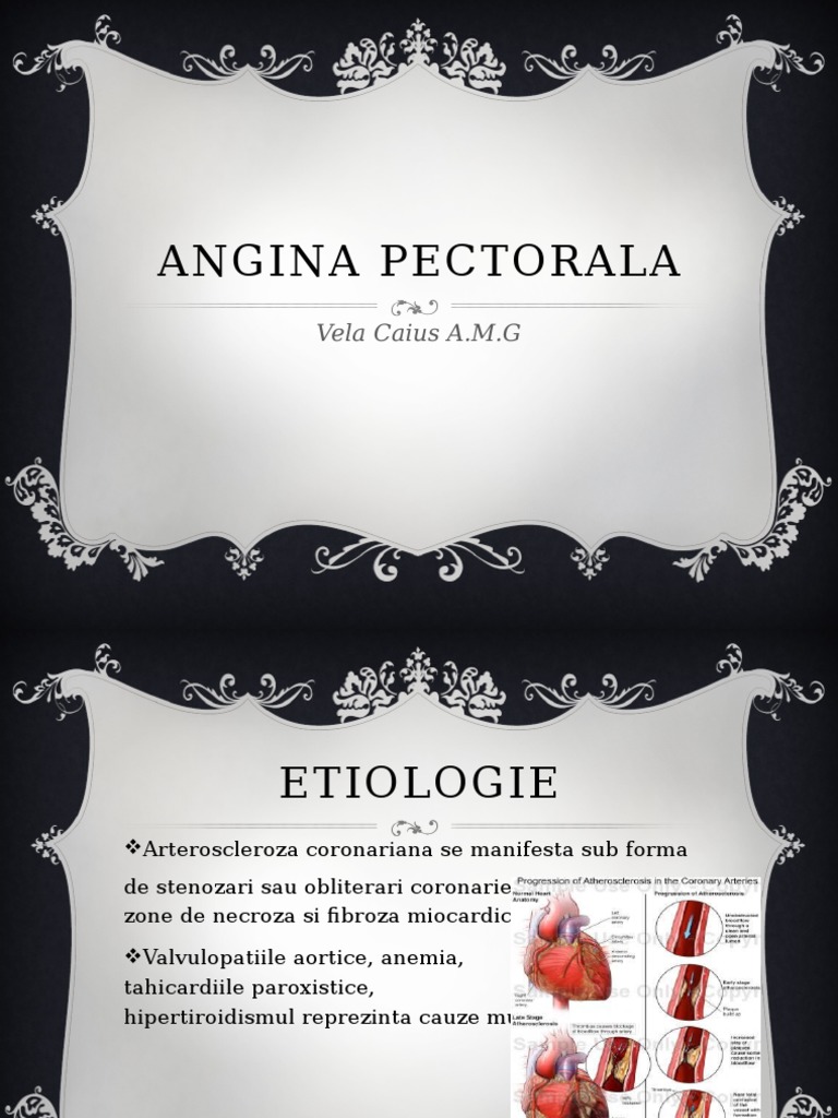 Angina Pectorala | PDF