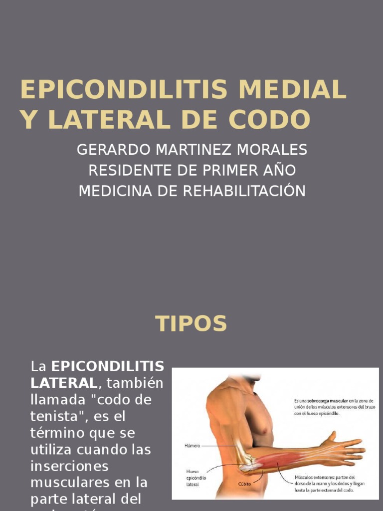 Epicondilitis Medial y Lateral de Codo Gerar | PDF | Codo | Tejido suave