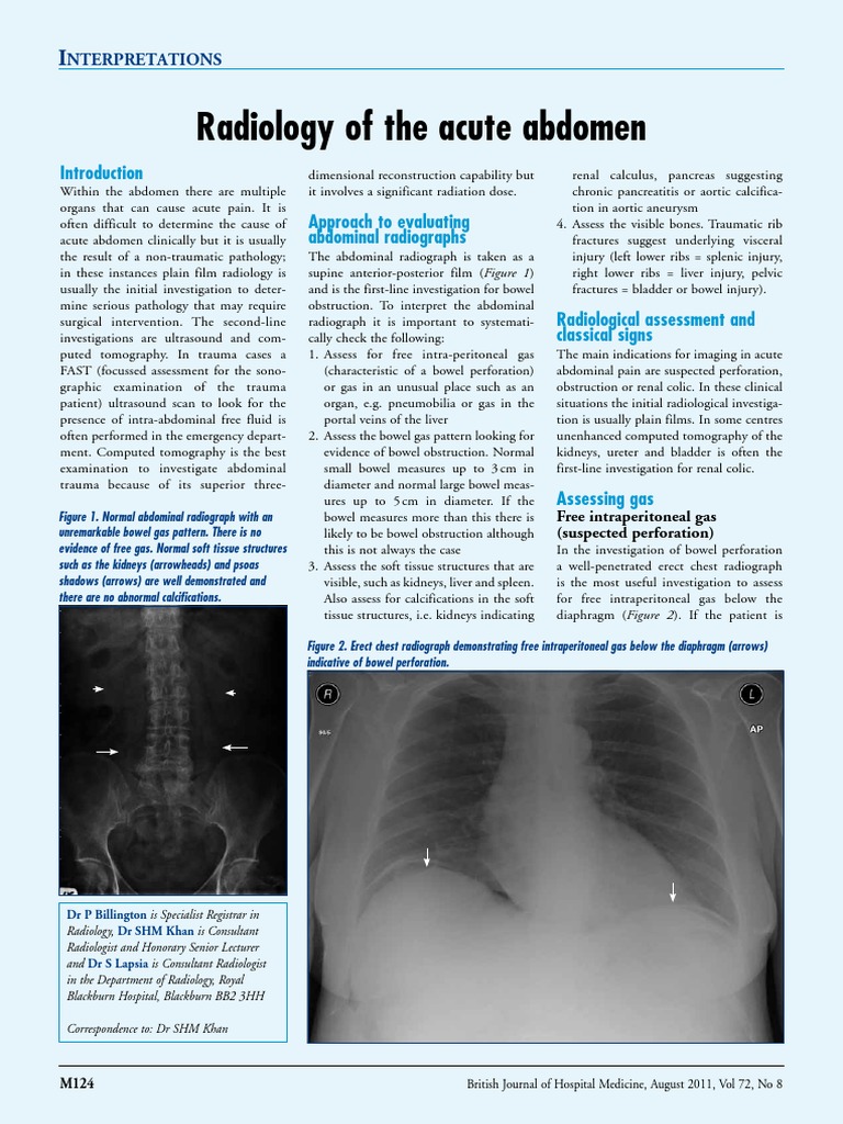 Radiology of The Acute Abdomen | PDF | Radiology | Large Intestine