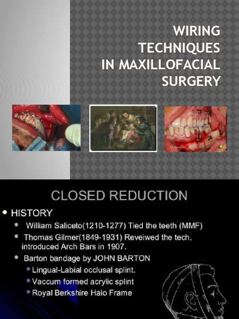 Wiring Techniques | PDF | Tooth | Mouth
