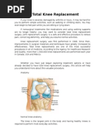 Total Knee Replacement Guide | PDF | Knee | Osteoarthritis