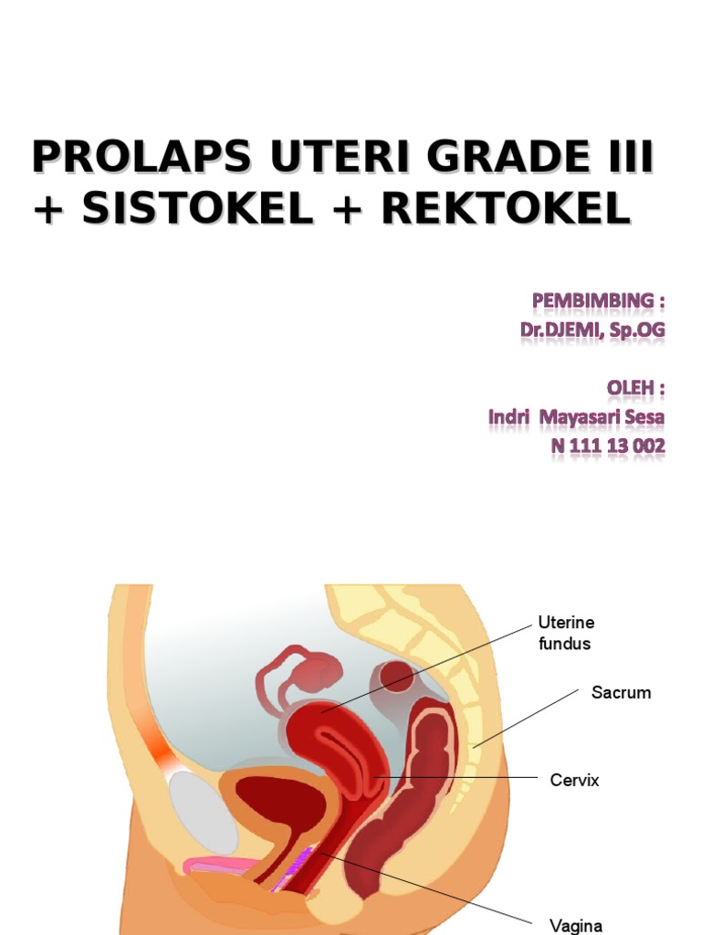Prolaps Uteri | PDF