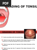Grading of Tonsil | PDF