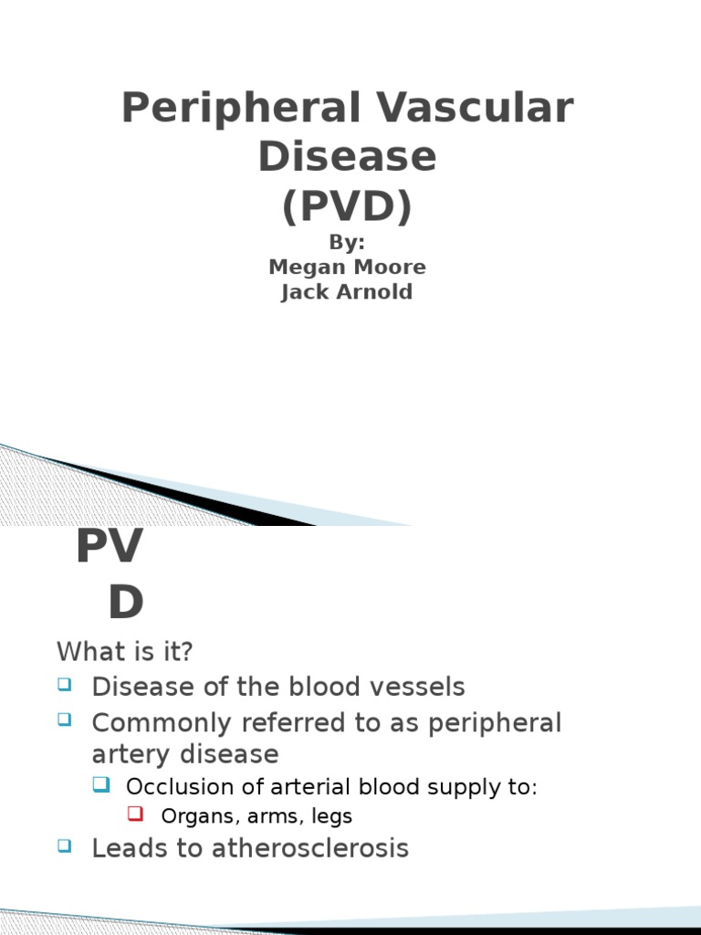 Understanding Peripheral Vascular Disease | PDF