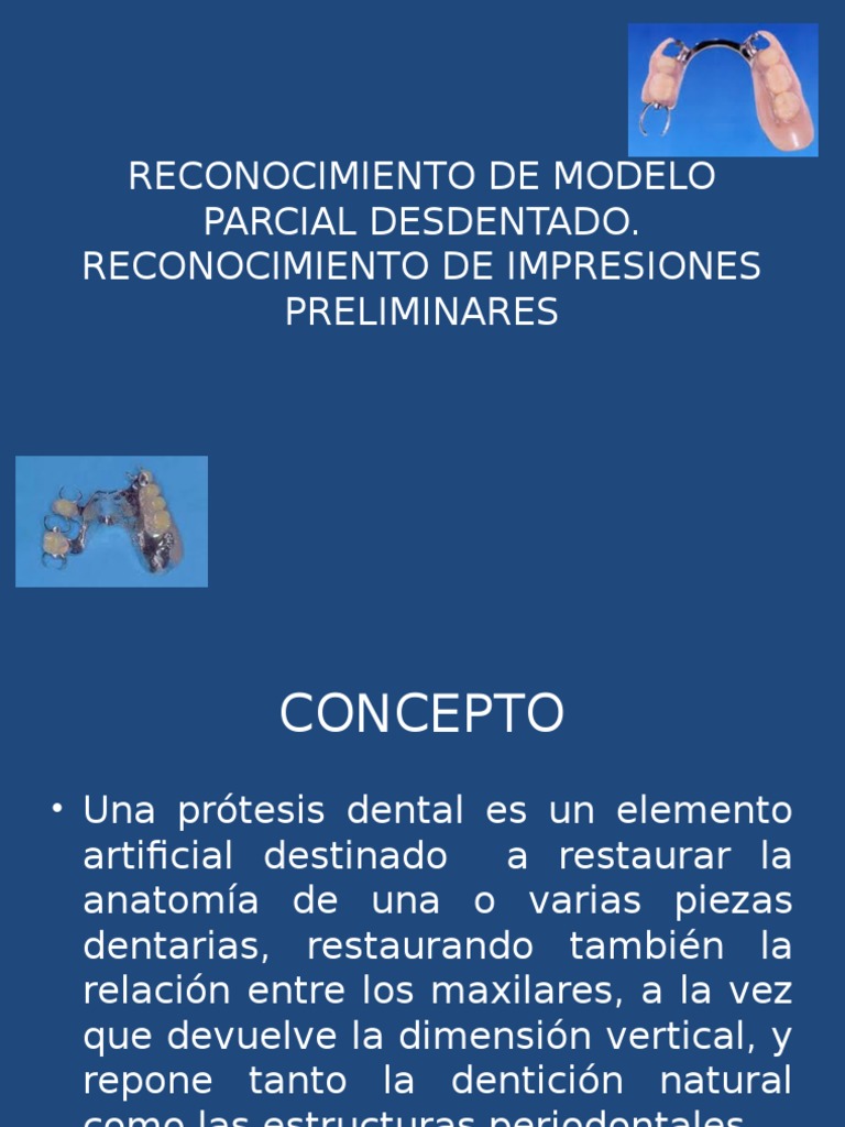 Reconocimiento de Modelo Parcial Desdentado | PDF | Dentadura postiza ...