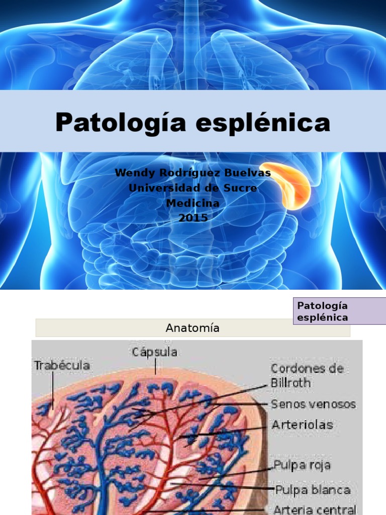 Patología Esplénica | Leucemia | Linfoma