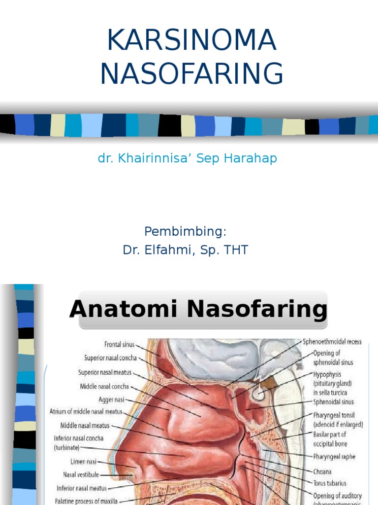 KARSINOMA NASOFARING | PDF