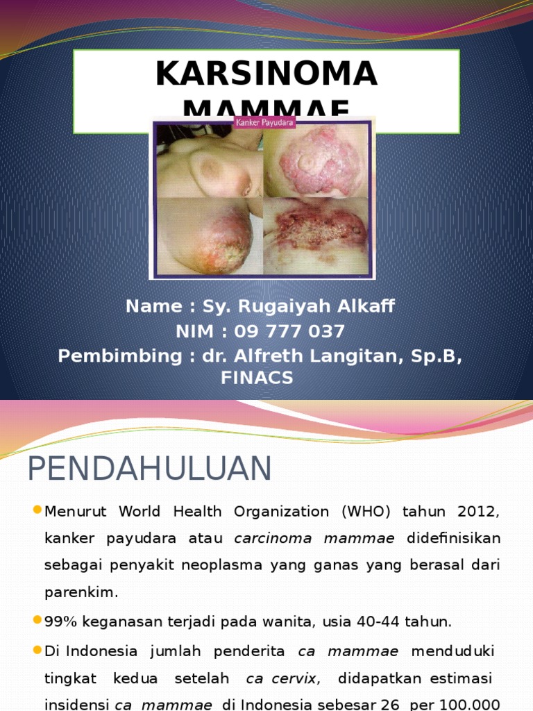 Karsinoma Mammae | PDF