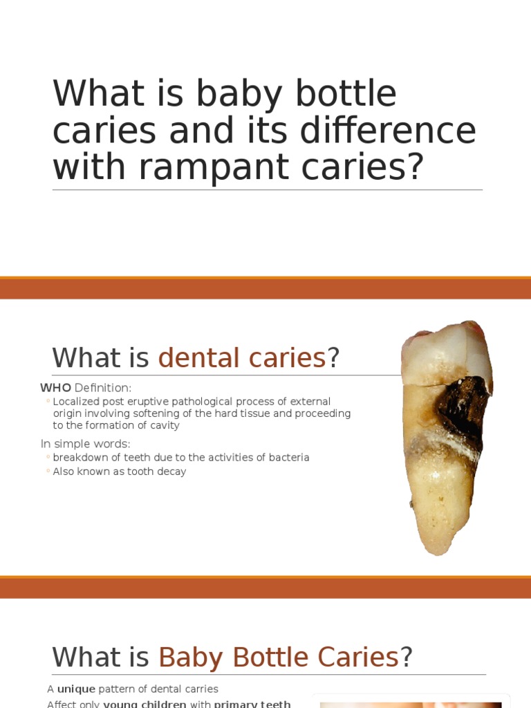 Baby Bottle Caries vs. Rampant Caries | PDF | Human Tooth | Dentistry