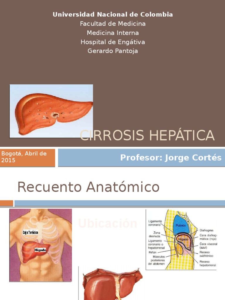Cirrosis Hepatica GAPL - 1 | PDF | Cirrosis | Sistema digestivo