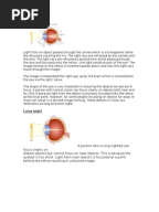 Air Optix Multi Focal Fitting Guide | Human Eye