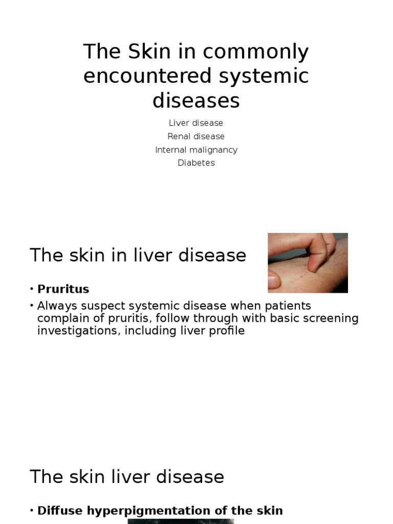 The Skin in Systemic Diseases | PDF | Cutaneous Conditions | Medicine