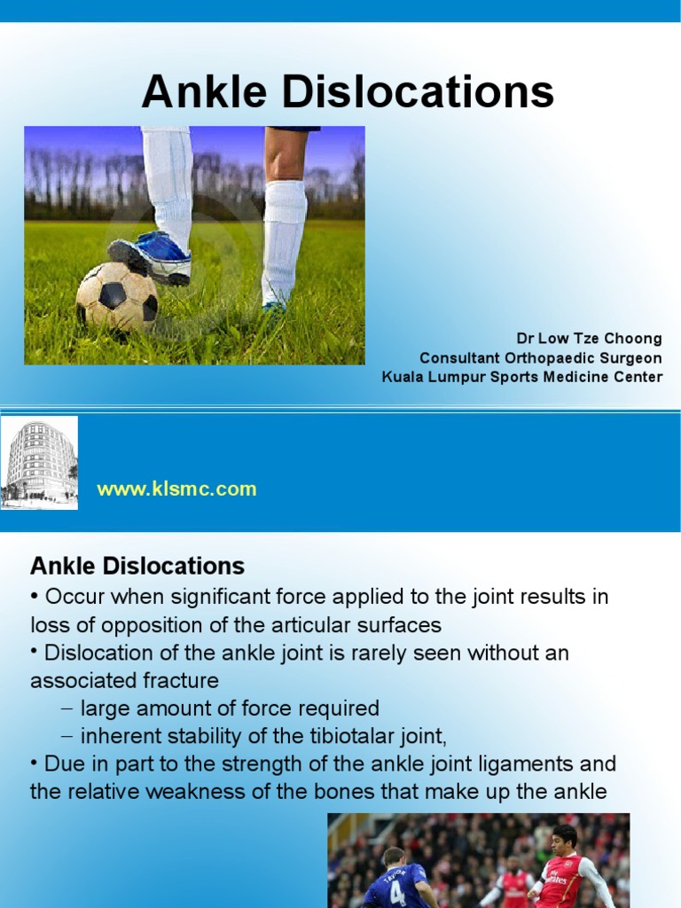 Ankle Dislocations Health Conference 2010 | PDF | Ankle | Foot