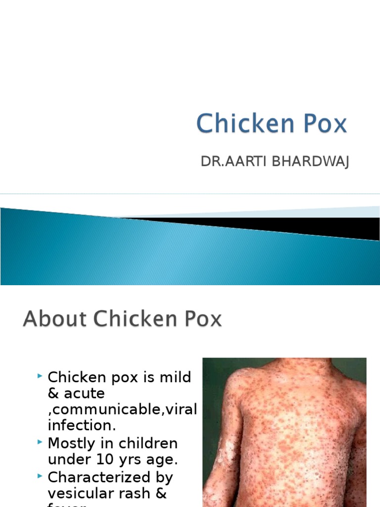 Chicken Pox | PDF | Viral Diseases | Animal Viral Diseases