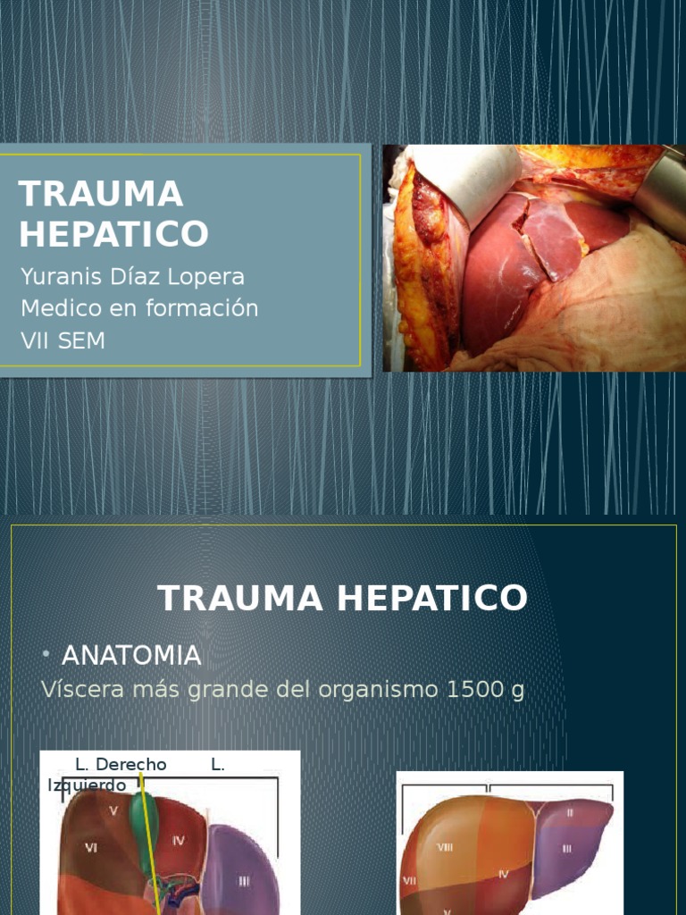 Trauma Hepatico | PDF | Lesión | Hígado