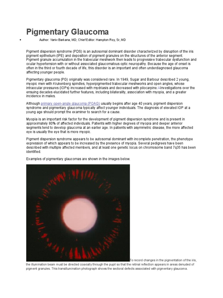Pigmentary Glaucoma | Glaucoma | Ophthalmology